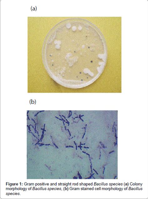 Isolation And Development Of Efficient Bacterial Consortia For Bi