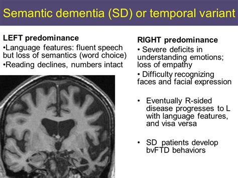 Frontotemporal Dementia Ftd Ppt Download