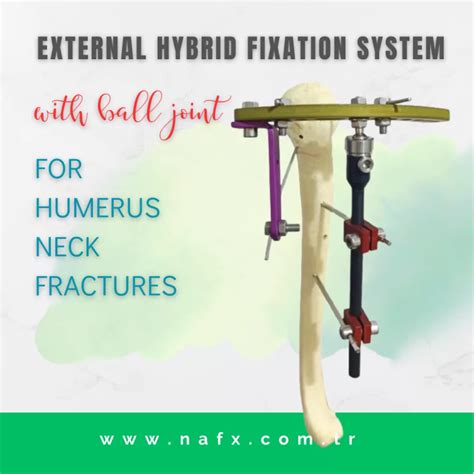 External Fixation System Large Tubular Fixator