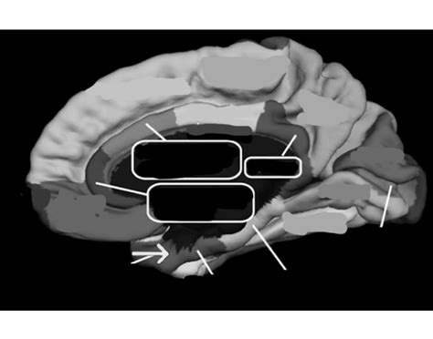 Prosencephalon — Printable Worksheet