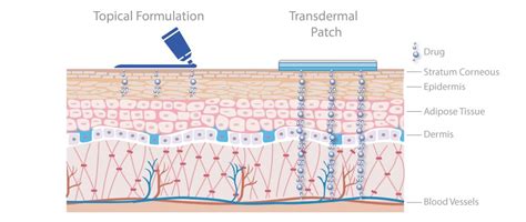 Topical And Transdermal Drug Products Making The Difference Through Transdermal Delivery
