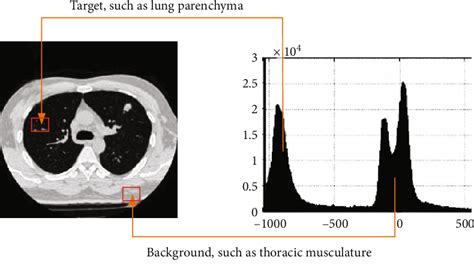 Figure 1 From Design Computer Aided Diagnosis System Based On Chest Ct Evaluation Of Pulmonary
