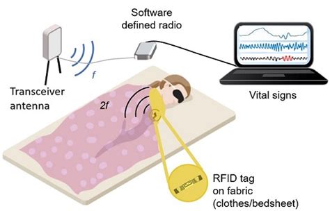 Wearable Near Field Radio Frequency Sensor For Cardio Pulmonary Monitoring RF Vital Sensing