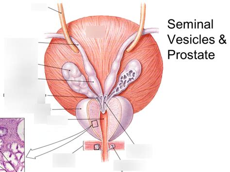 Cross Sectional Imaging Of Seminal Vesicles And Vasa 51 Off