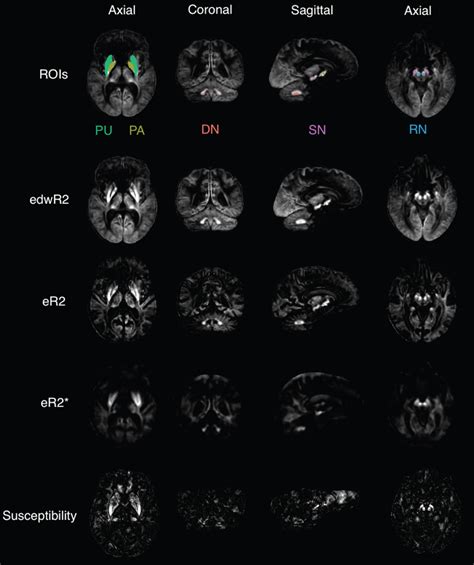 r‐squared values of all image types linearly regressed with age scaled