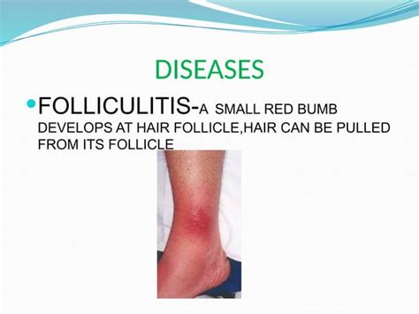 Staphylococcus Introduction History Morphology Ppt