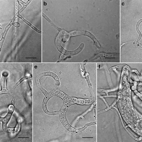 Pdf Proteomic And Transcriptional Analyses Of Arthrobotrys Oligospora Cell Wall Related