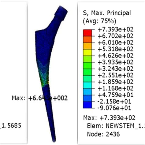A Custom Designed Hip Stem With Healthy Femur Bone Interface B 2d Mesh
