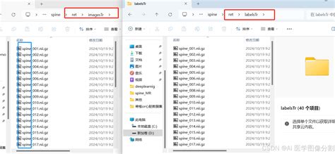 第四章：nnunet大模型之环境配置、数据集制作 unet数据集制作 csdn博客
