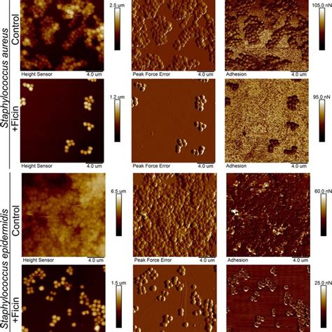 Atomic Force Microscopy Peak Force Tapping Mode Of Intact And Download Scientific Diagram