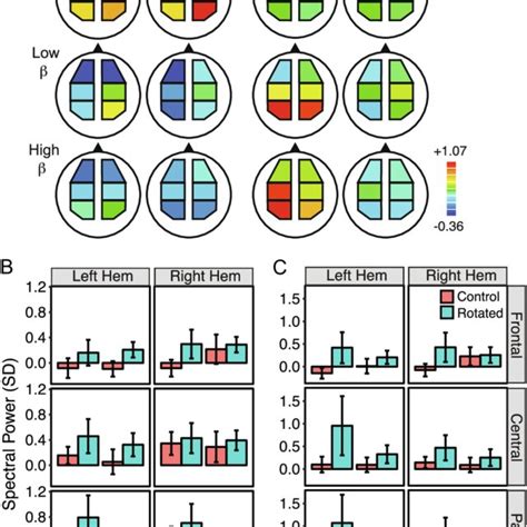 Standardized Eeg Spectral Power In Units Of Standard Deviation