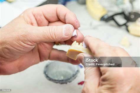 치과 기술자 3d에 치아에 대 한 인쇄 형 임 플 란 트 3차원 인쇄에 대한 스톡 사진 및 기타 이미지 3차원 인쇄 3차원 형태 Stem 주제 Istock