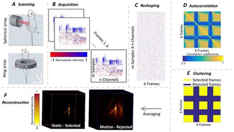 Applied Sciences Special Issue Photoacoustic Tomography Pat