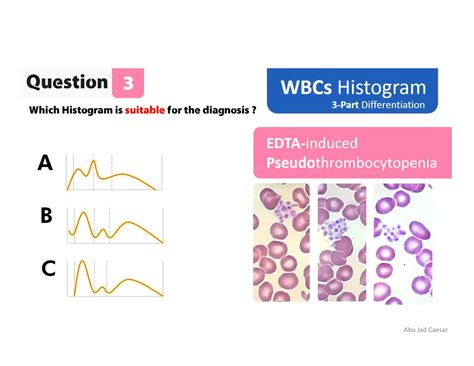 Wbc Histogram Pdf