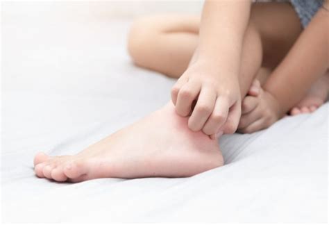 How To Tell If You Have Fleas In Your Bed Effective Recognition And Solutions Pest Samurai