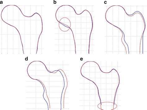 5 Typical Cases Of Paired Femur Contours Download Scientific Diagram