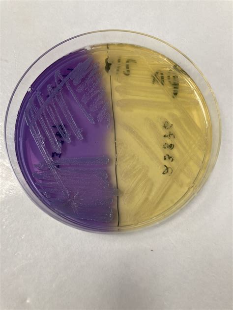Mary Sekiya On Linkedin Staph Aureus And Staph Pseudintermedius I Couldnt Have Plated A Better…