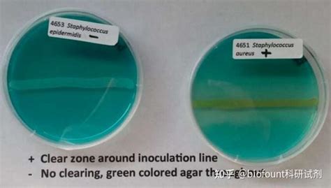 脱氧核糖核酸酶 Dnase 测试 原理、程序、用途、结果解释 知乎