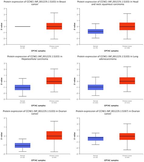 Pan Cancer Analysis Identifies The Oncogenic Role Of Ccne1 In Human Cancers Figure F5 Aging