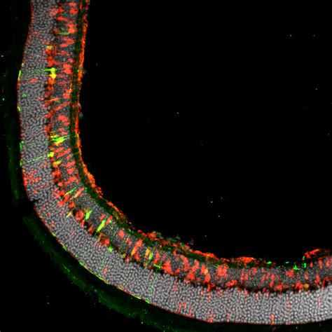 Regenerating Retinal Neurons Using Aav Vectors Iscrm