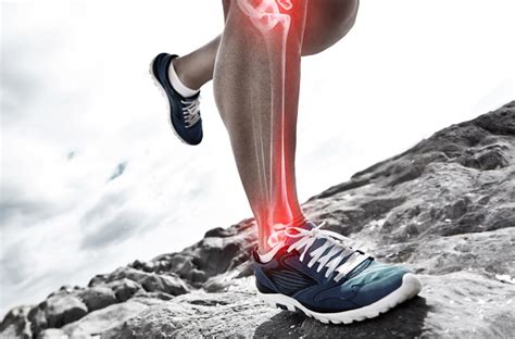 Shin Splints Causes Symptoms And Treatments