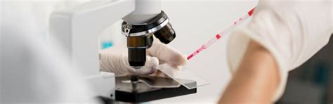 Hematology Tests Jind Lab