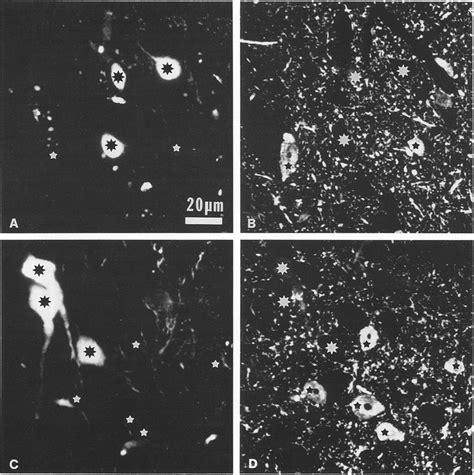 A D Confocal Laser Scanning Photomicrographs Of FITCpositive