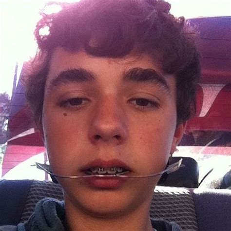 Pin By Bruce Nicolosi On Adult Braces Headgear Adult Braces