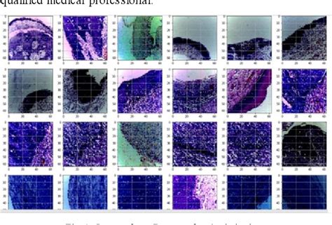 Figure 3 From Analysis Of Deep Learning Based Optimization Techniques For Oral Cancer Detection