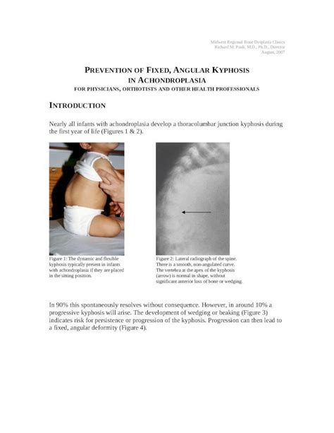 Doc Prevention Of Fixed Angular Kyphosis Dokumen Tips