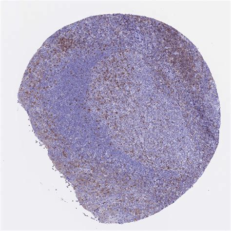 Tissue Expression Of Cd5 Staining In Tonsil The Human Protein Atlas