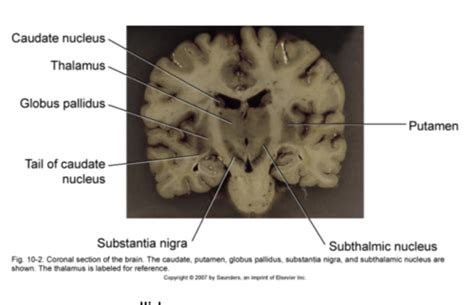 Subthalamic Nucleus Anatomy