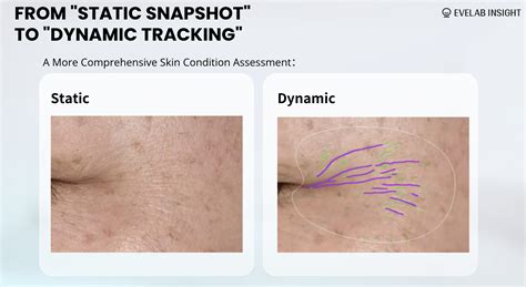 Evelab Insight Debuts Dynamic Wrinkle Detection Technology At Vivatech