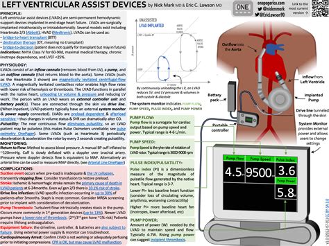 Non Pulsatile Ventricular Assist Devices