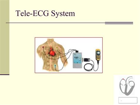 Intelligent Heart Disease Recognition Using Neural Networks Ppt