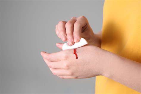 When To Go To Er For Cut Signs And Treatment