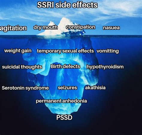 Exploring The Gut Brain Connection Managing Ssri Digestive Side Effec