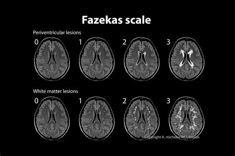A Glossary Of Commonly Used Classifications In Medical Imaging