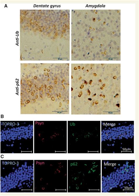 α Synuclein Pathology In Fibril Injected Mice Brain Was Immunoreactive