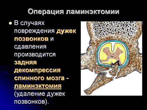 Травма позвоночника и спинного мозга презентация онлайн