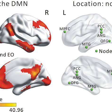 Spatial Distribution Of Temporal Correlations For The Posterior Download Scientific Diagram