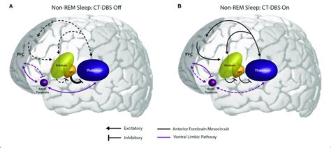 Proposed Mechanism Linking The Observed Effects Of CT DBS In Our Download Scientific Diagram