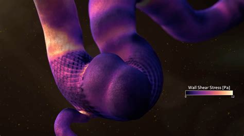 Pipeline Embolization Device On Behance