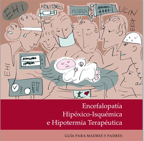 Encefalopatía Hipóxico Isquémica Un Recurso Para Conocerla Mejor Sepeap