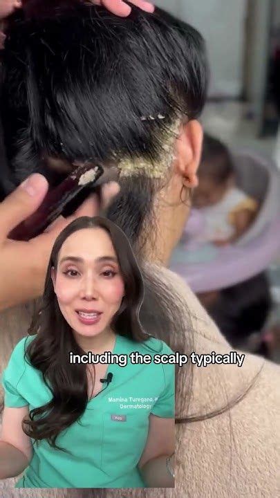 Derm Reacts To Scaly Scalp Scaly Scalp Dry Scalp Treatment Hair