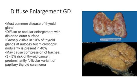 Practical 3 Thyroid Pathology 2019 Pptx