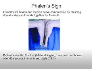 Carpal Tunnelsyndromea Patientcase Pdf