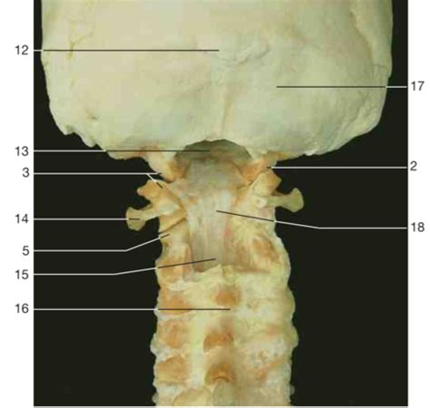 Atlanto Occipital Atlanto Axial Joint E3 Flashcards Quizlet