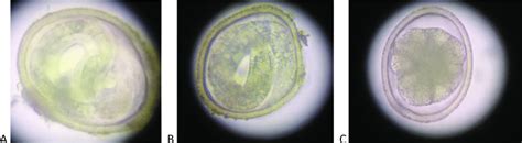 Toxocara Forms Isolated In Nyc Specimens A And B Larvated Infective Download Scientific