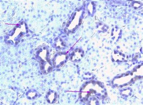 Ang Blocking Peptide MyBioSource